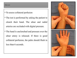Arterial cannulation power point presentation | PPTX