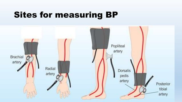 Hemodynamic monitoring non invasive | PPTX | First Aid | Injuries