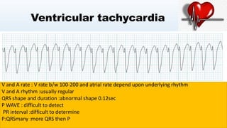 Hemodynamic monitoring non invasive | PPTX