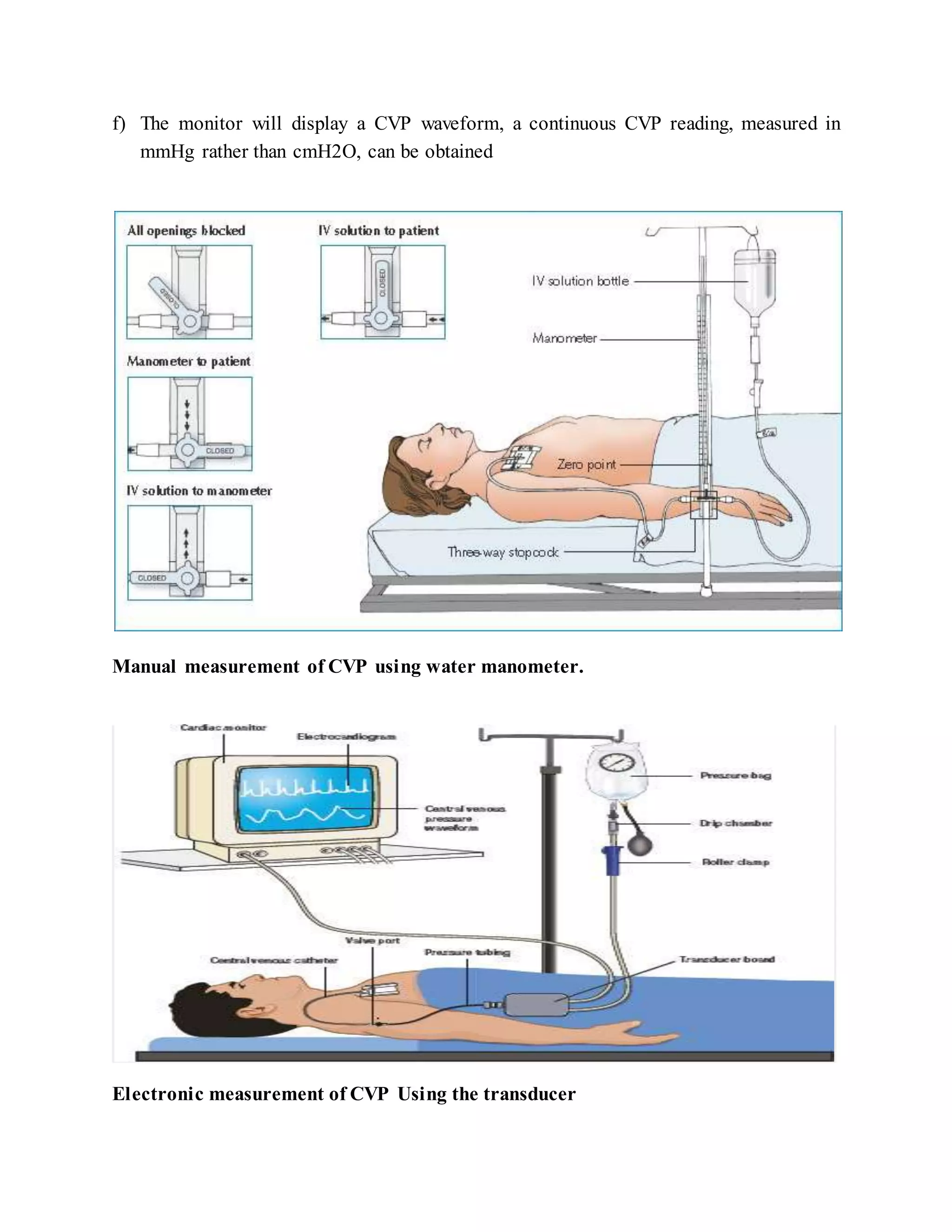 Hemodynamic monitoring of critically ill patients | DOCX