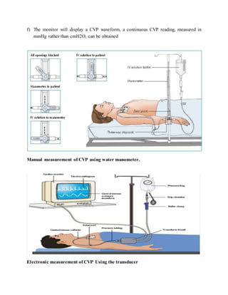 Hemodynamic monitoring of critically ill patients | DOCX