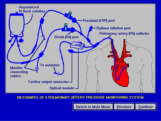 Hemodynamic monitoring ppt