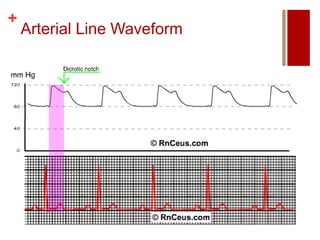 Hemodynamic monitoring r weinzierl | PPT