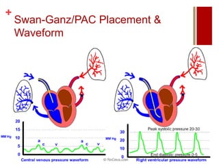 Hemodynamic monitoring r weinzierl | PPT