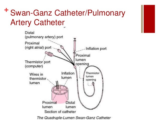Hemodynamic monitoring r weinzierl