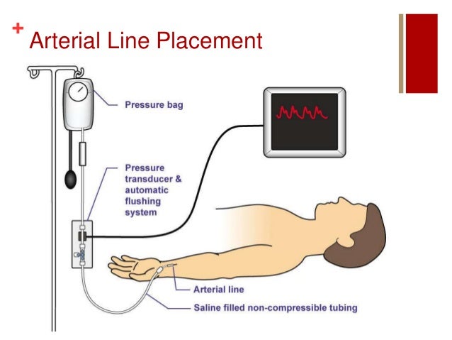 Hemodynamic monitoring r weinzierl