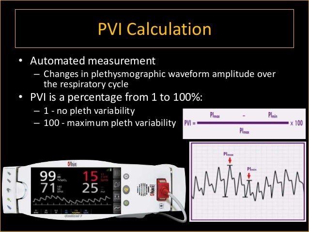 Hemodynamic parameters & fluid therapy Asim