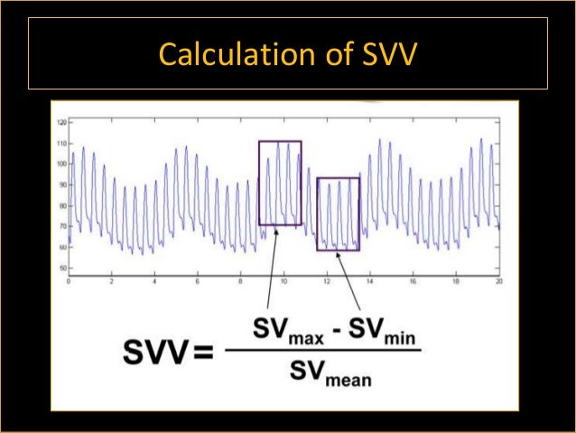 Hemodynamic parameters & fluid therapy Asim