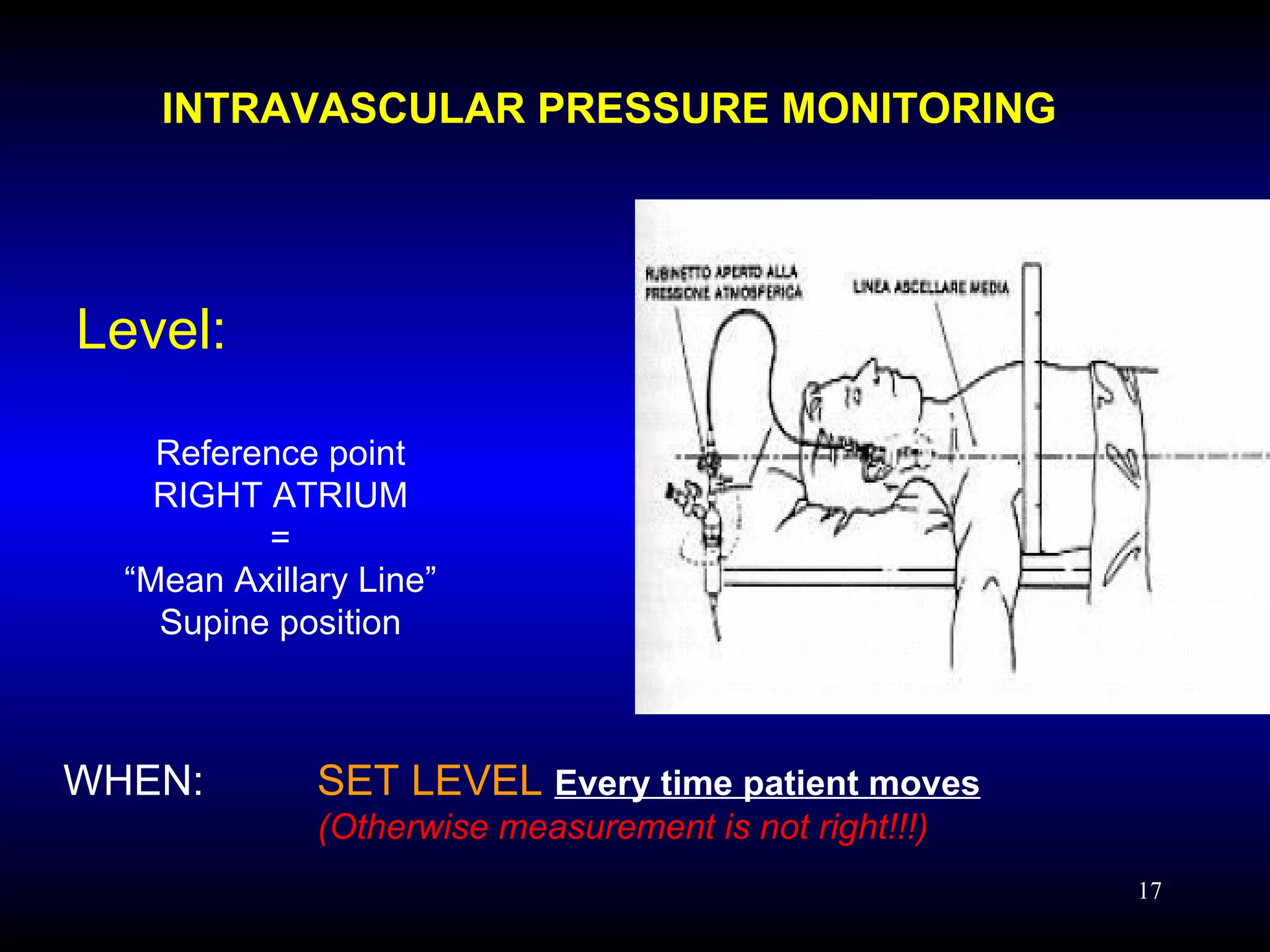 Hemodynamic Pressure Monitoring | PPT