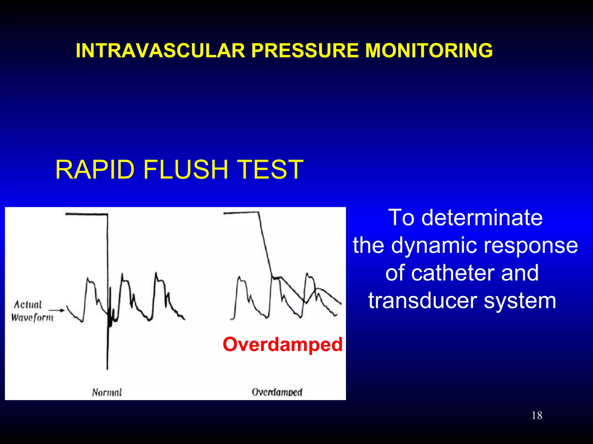 Hemodynamic Pressure Monitoring | PPT