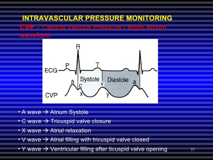 Hemodynamic Pressure Monitoring