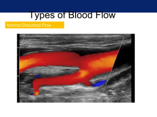 Hemodynamic principles ms limu monday 2017 | PPT