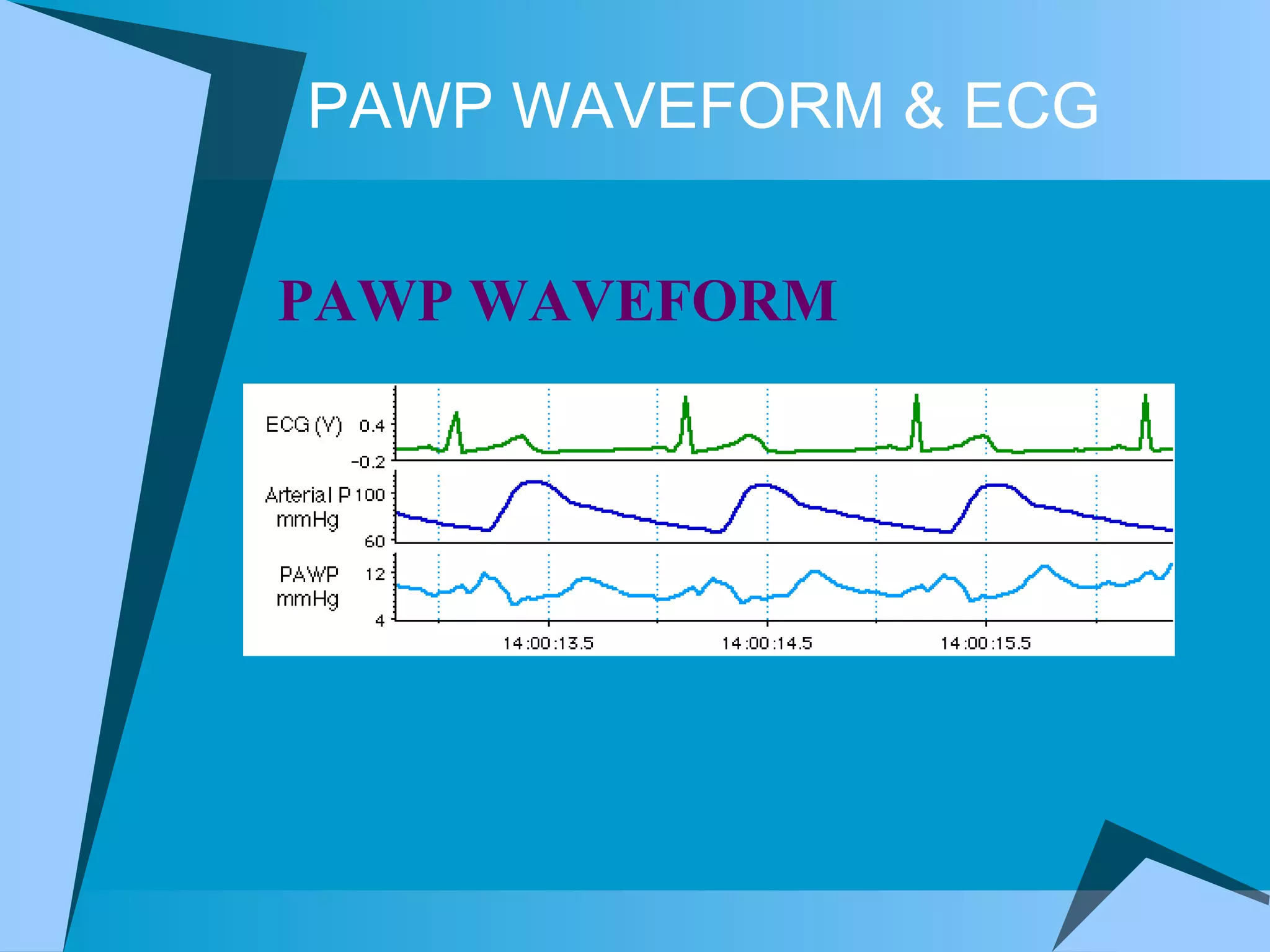 Hemodynamics | PPT