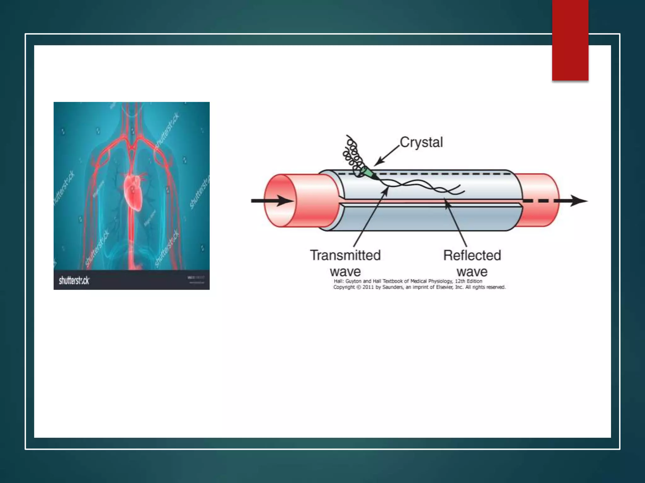 Hemodynamics over view of circulation | PPT
