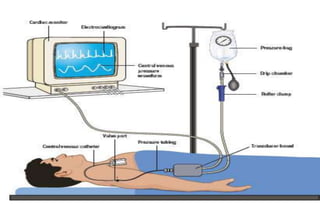 CRITICAL AND CARE NURSING hemodynamics.pptx