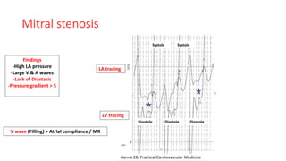 Hemodynamics assessment in the Catheterization lab | PPT