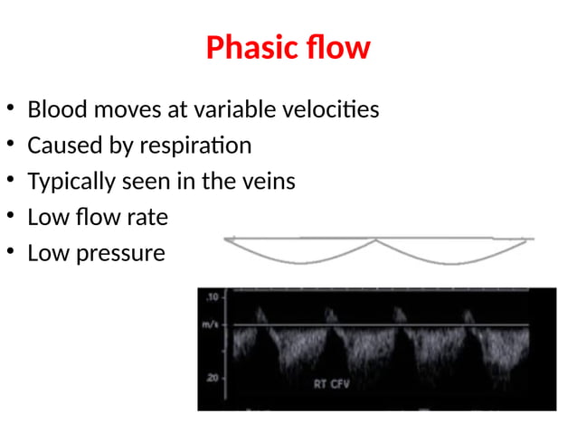 hemodynamics of flow . introduction to types of flow | PPTX
