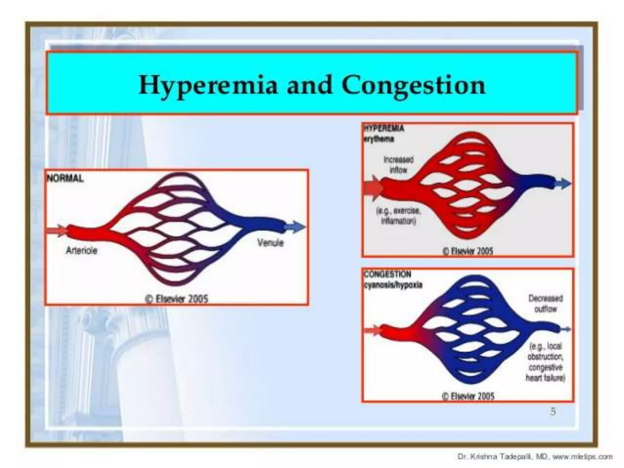 Hemodynamics congestion & hyperemia | PPTX