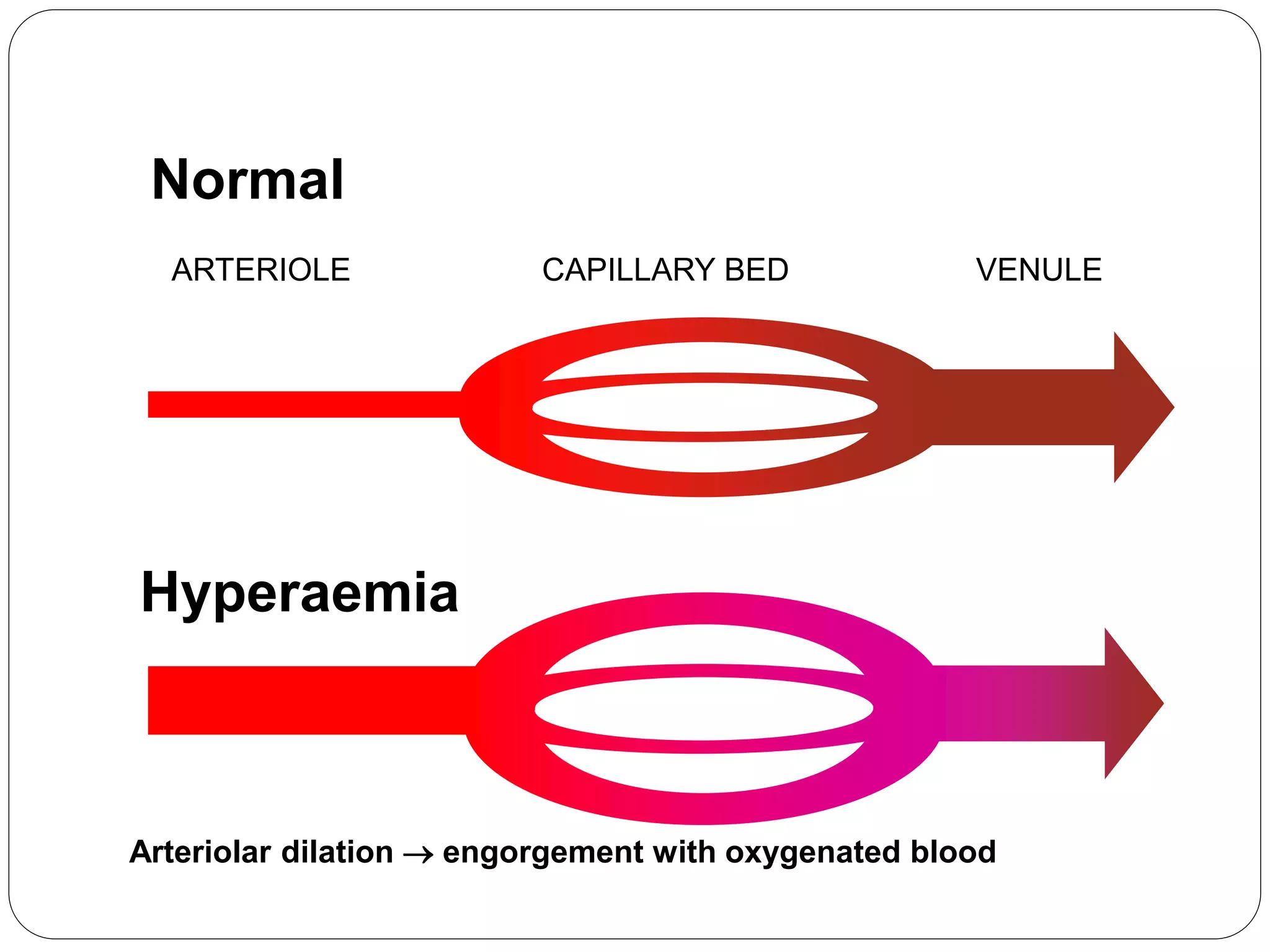 Hemodynamics congestion & hyperemia | PPTX