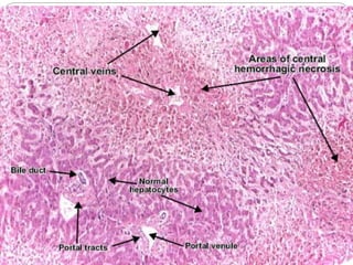 Hemodynamics congestion & hyperemia | PPTX