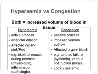 Hemodynamics congestion & hyperemia | PPTX