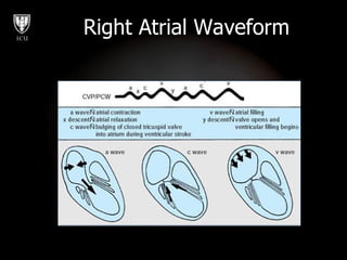 Hemodynamics In The Icu | PPT