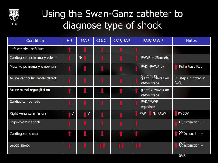 Hemodynamics In The Icu