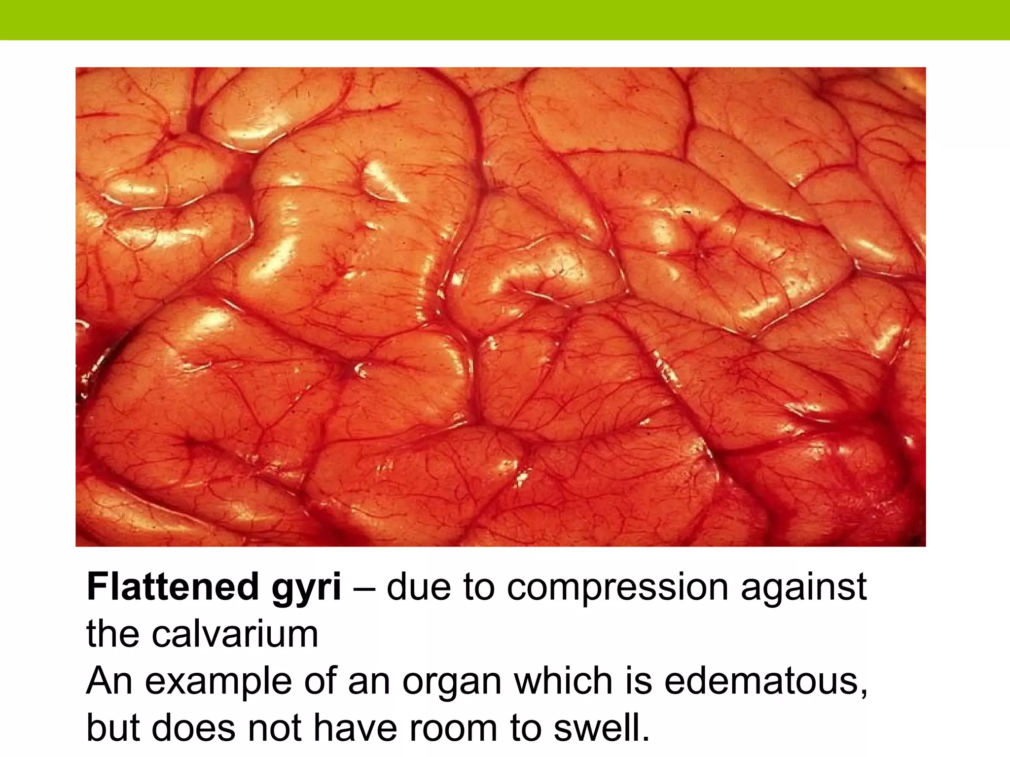Hemodynamics disorders | PPT