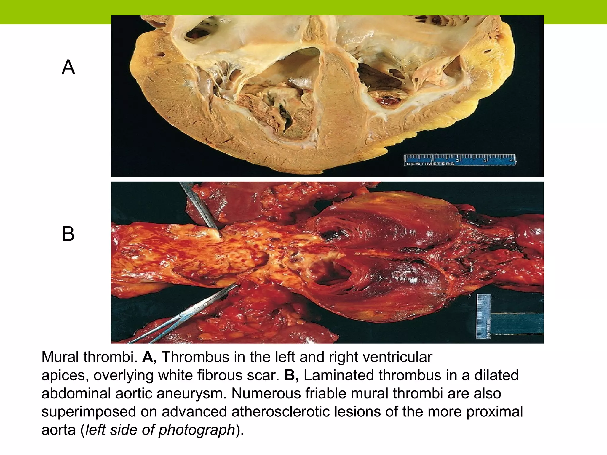 Hemodynamics disorders | PPT