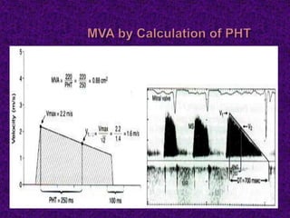 Hemodynamics in echo lab by Dr. Ranjeet S.Palkar | PPTX