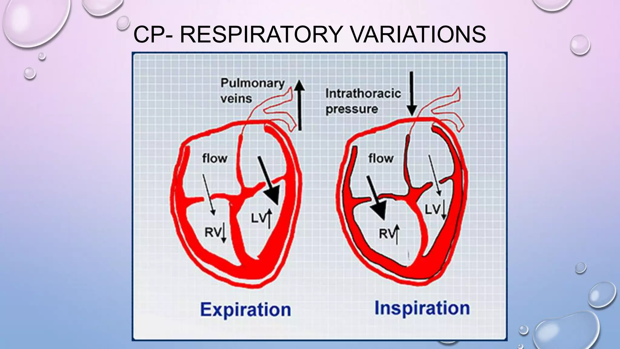 Hemodynamics of cardiac tamponade, constrictive pericarditis ...