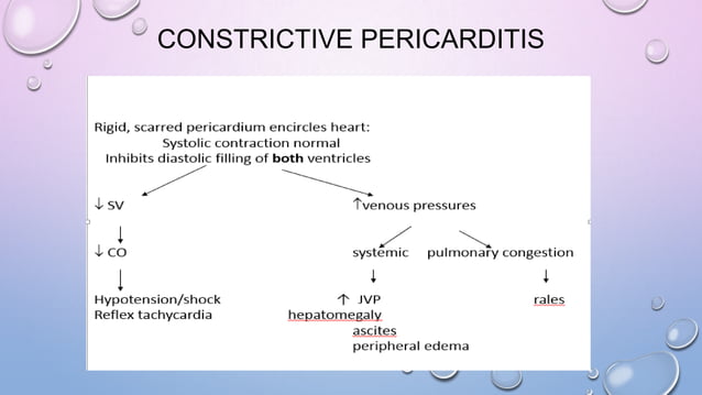Hemodynamics of cardiac tamponade, constrictive pericarditis ...