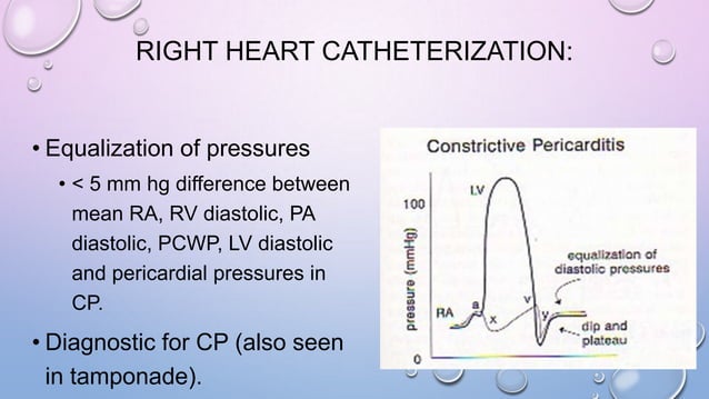 Hemodynamics of cardiac tamponade, constrictive pericarditis ...