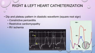 Hemodynamics of cardiac tamponade, constrictive pericarditis ...