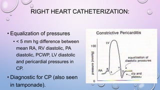 Constrictive Pericarditis Hemodynamics