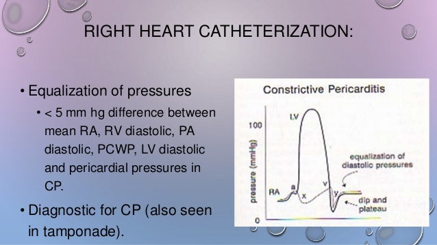 Hemodynamics of cardiac tamponade, constrictive pericarditis & restri…