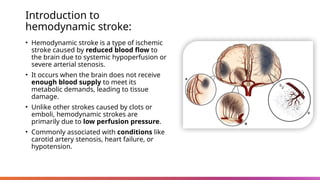 Neurology Hemodynamic stroke brain stroke | PPTX