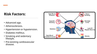 Neurology Hemodynamic stroke brain stroke | PPTX