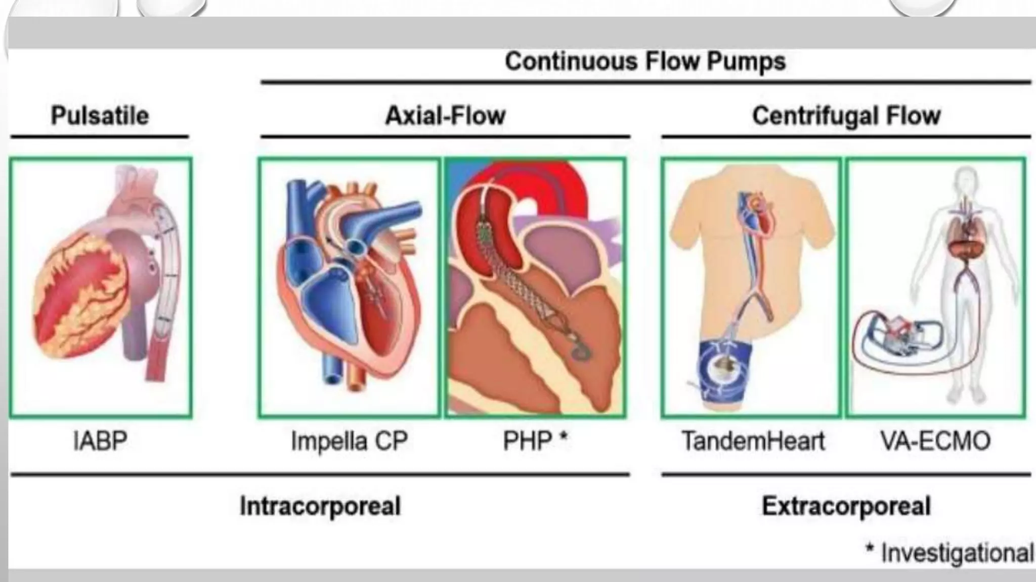 hemodynamic support in STEMI.pptx | Heart and Cardiovascular Diseases | Diseases and Conditions