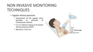 HEMODYNMAMICS MONITORING IN CRITICAL CARE NURSING | PPTX