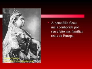 Hemofilia Ppt