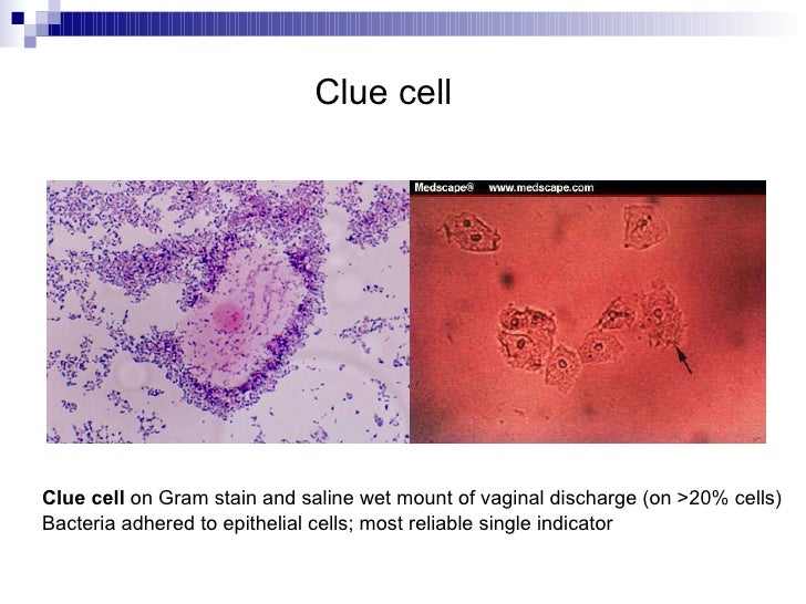 Hemofilus+bordetela+gardnerela