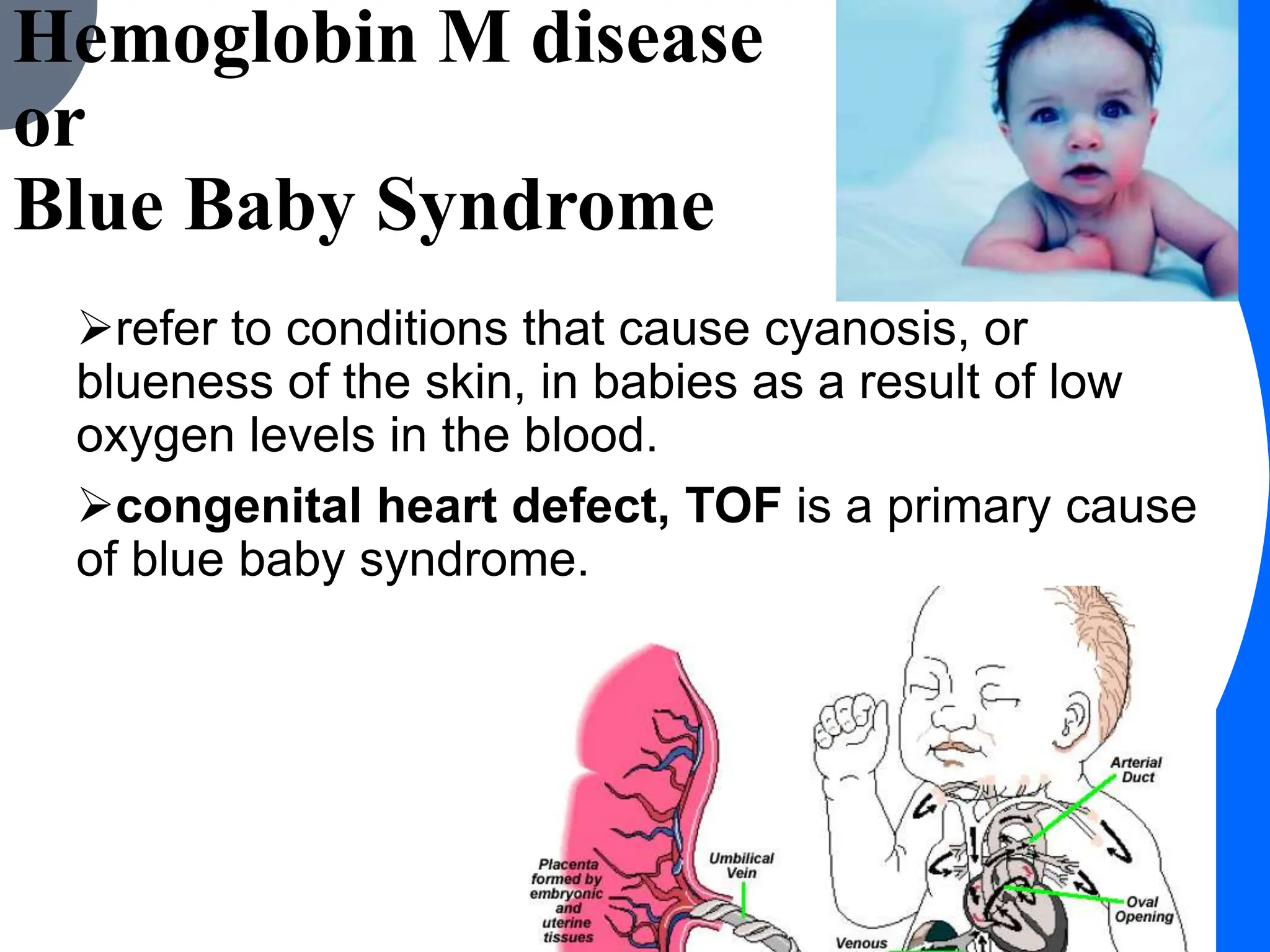 hemoglobin and iron metabolism.pptx