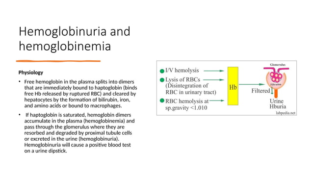Hemoglobinemia and hemoglobinuria in biochemistry | PPTX