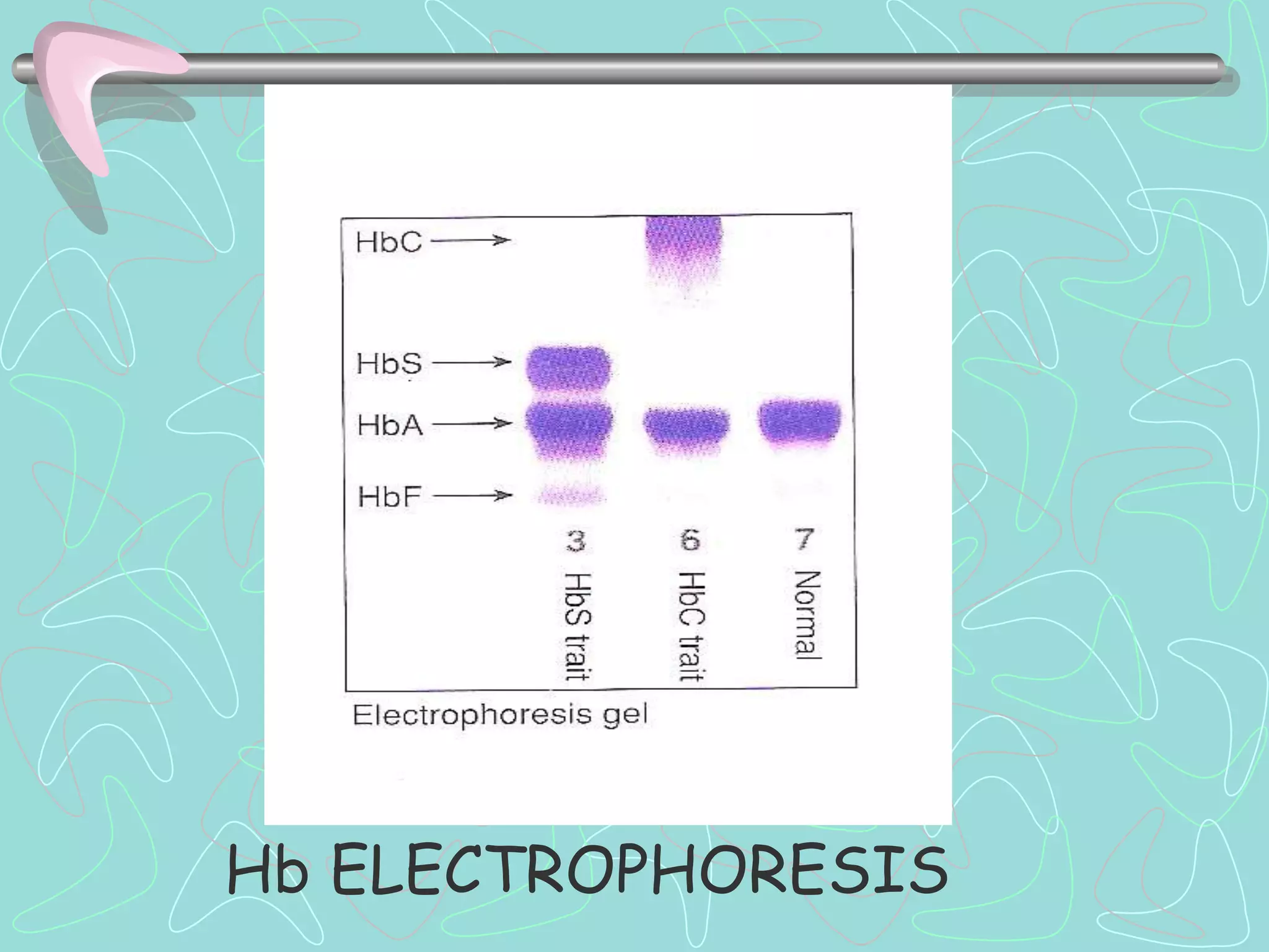 Hemoglobinopathies | PPT