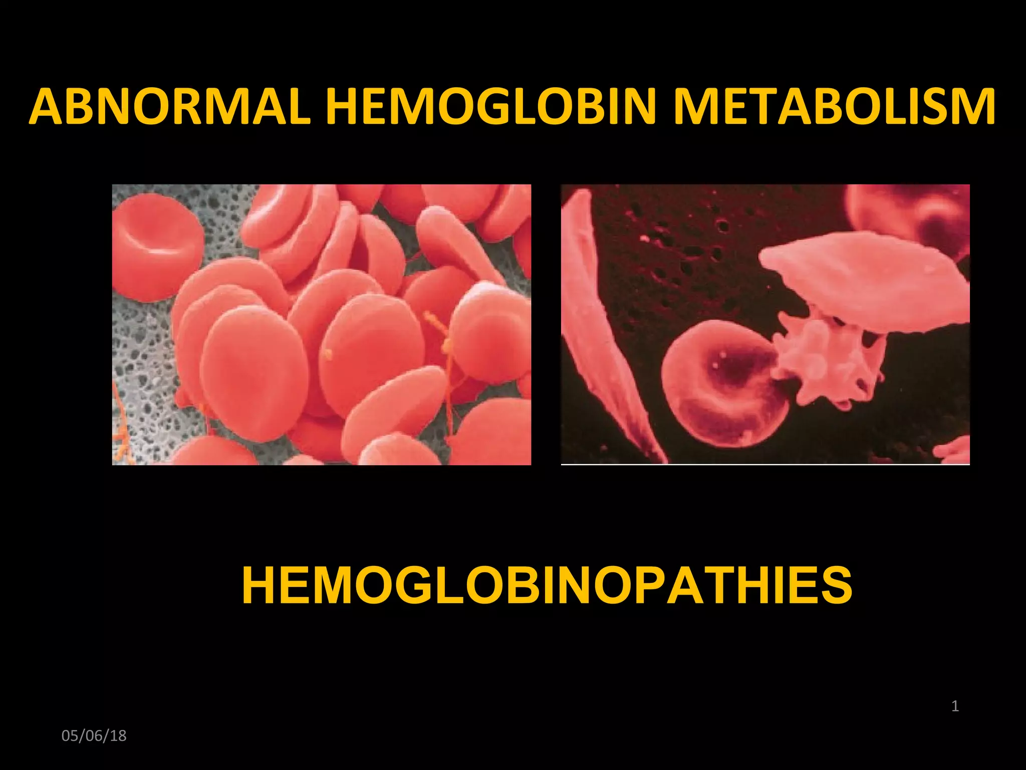 Hemoglobinopathies | PPT