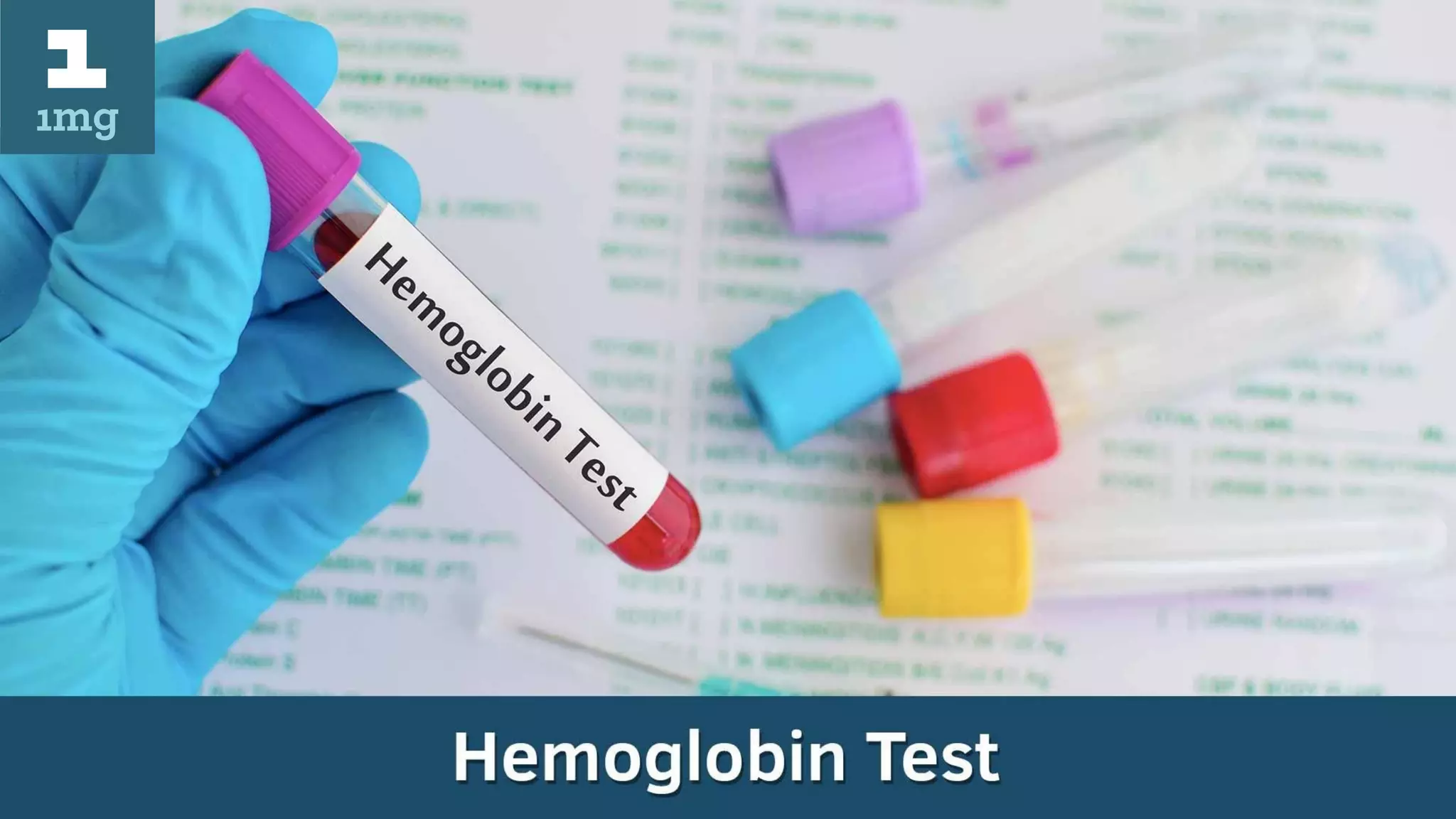 Hemoglobin (Hb) test 1mglabs | PPT