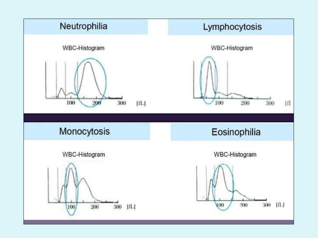 Interpretaion of hemogram | PPTX
