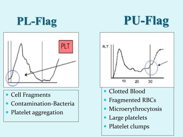 Interpretaion of hemogram | PPTX