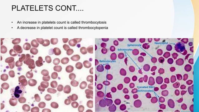 HEMOGRAM slides to help with health care | PPTX